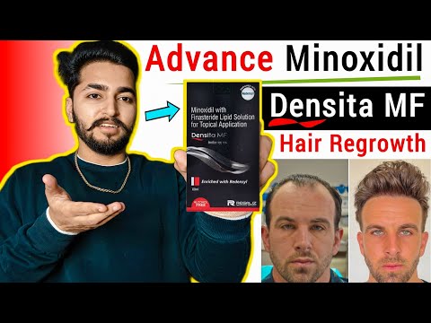 Minoxidil Finasteride Topical Solution - Minoxidil Finasteride Solution ...