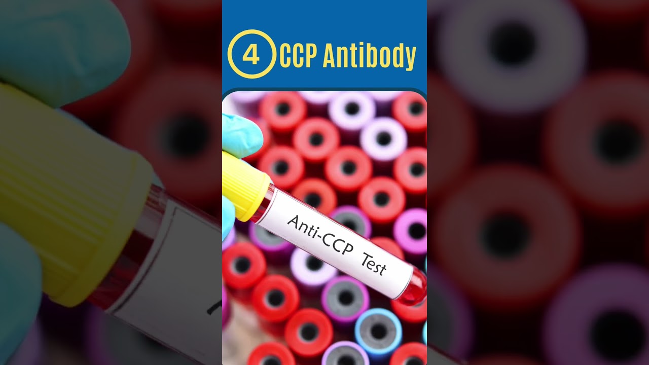 5 tests for autoimmune disease #autoimmunedisease #rheumatoidarthritis #sjogrens #lupus