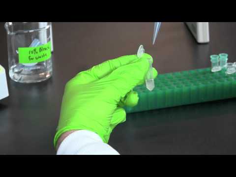 Alkaline Lysis Miniprep