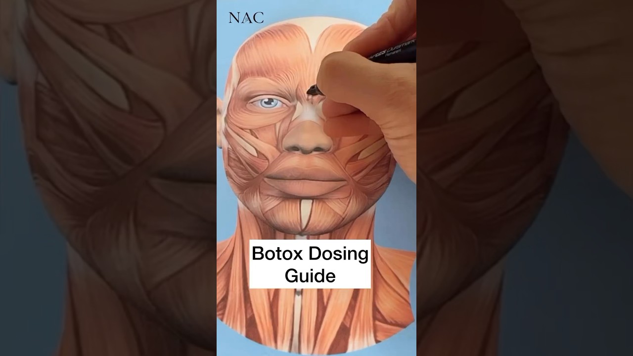 Botox Dosing Guide #botox #botoxtreatment #fillers