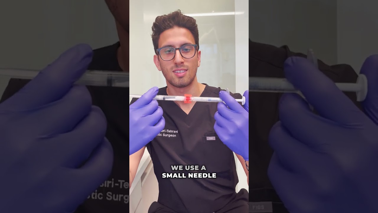 Hand Rejuvenation with dermal filler (Radiesse)