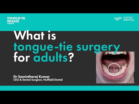 Tongue-Tie Adults: What is Tongue-Tie for Adults? (1/4)