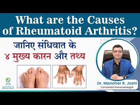 What are the Causes of Rheumatoid Arthritis जानिए संधिवात के 4 मुख्य कारन और तथ्य | Dr Manohar Joshi