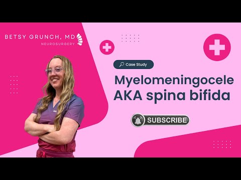 Case study 93- Myelomeningocele AKA spina bifida explained by Dr. Grunch, neurosurgeon #spinabifida