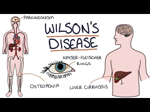 Understanding Wilson's Disease