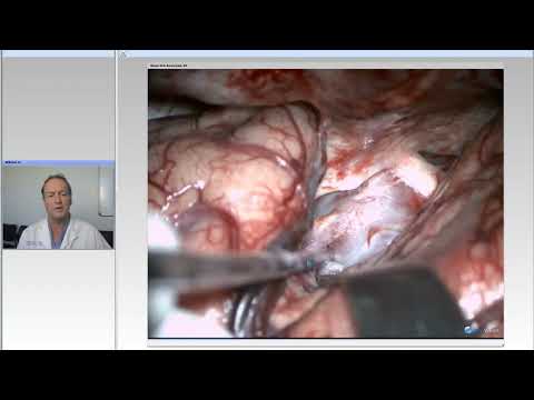 The Grand Rounds II: Complex Vascular Cases - Technical Pearls (Preview)