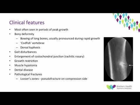 OrthoFracs Rickets Michael Bullen