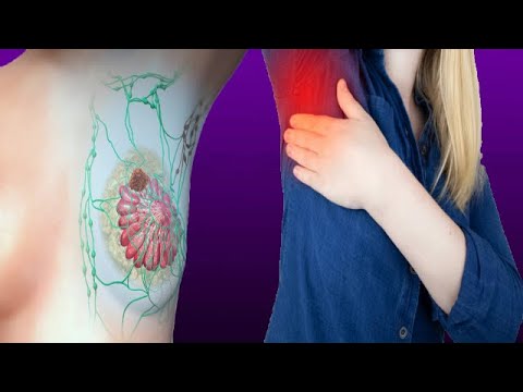 Armpit Pain: Causes And Treatment