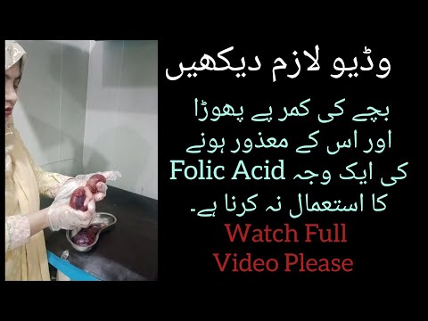 Premature And Abnormal Fetus | Pregnancy Talk | Pregnancy Tips