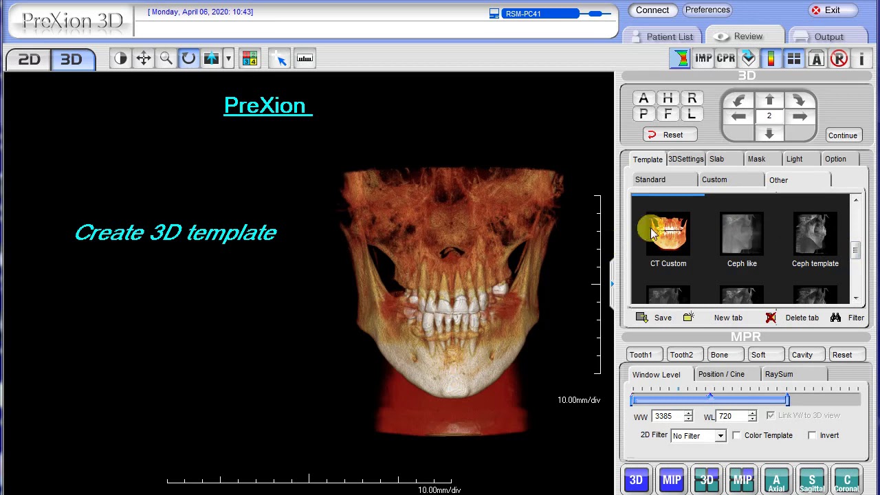 PreXion Training Tips: Create a 3D template.