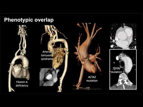 Imaging “Biomarkers” – Are We There Yet?