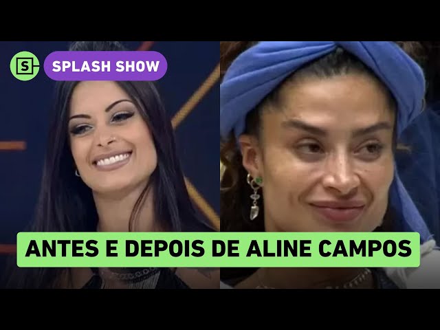 Aline Campos: veja antes e depois do rosto da participante do BBB 26