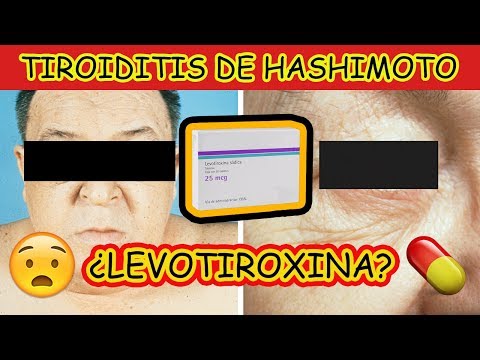 Endocrinología - Hipotiroidismo (Tiroiditis de Hashimoto)
