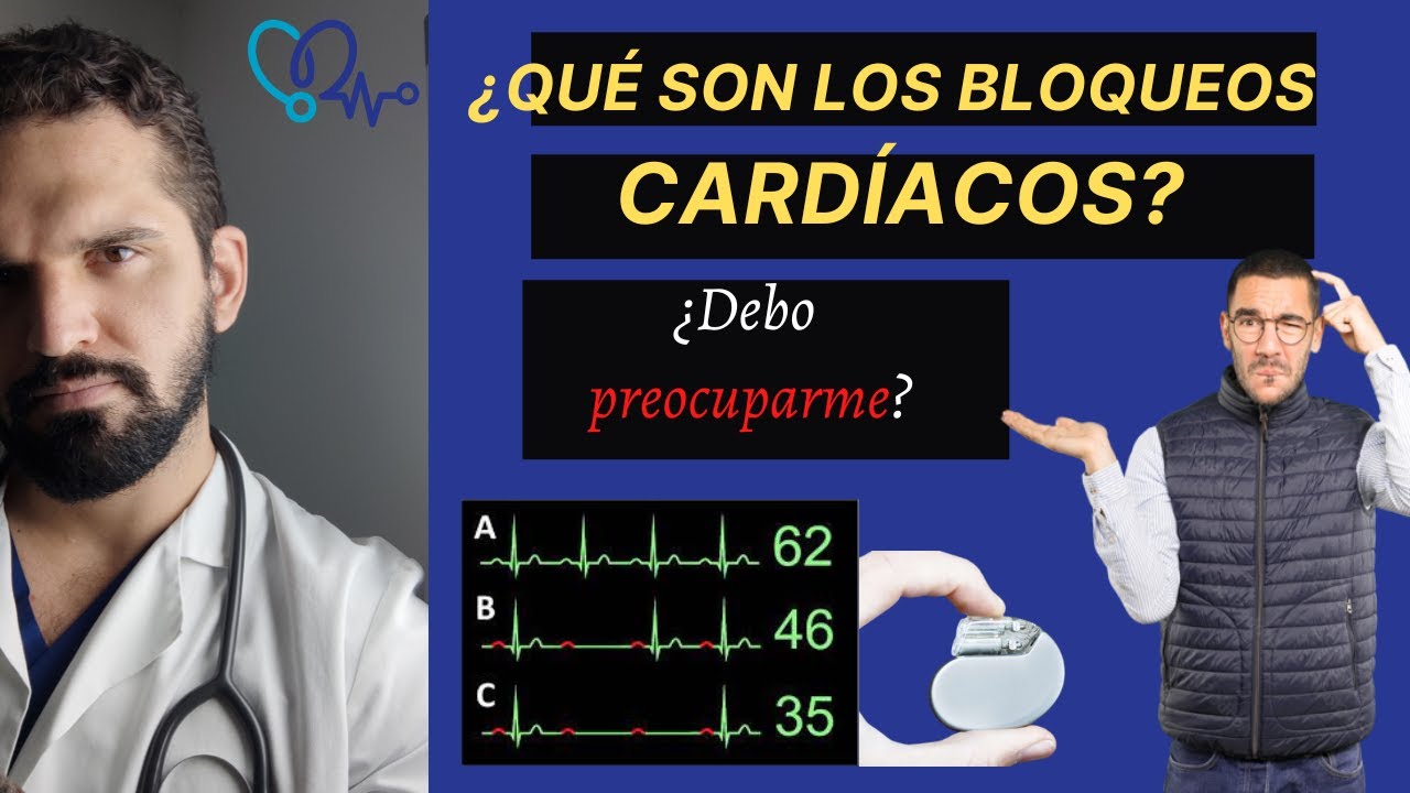 Heart blocks? 🛑😳 A.V. and branch blocks. Is it dangerous? ⚠. Here's a SUPER simple explanation ✅