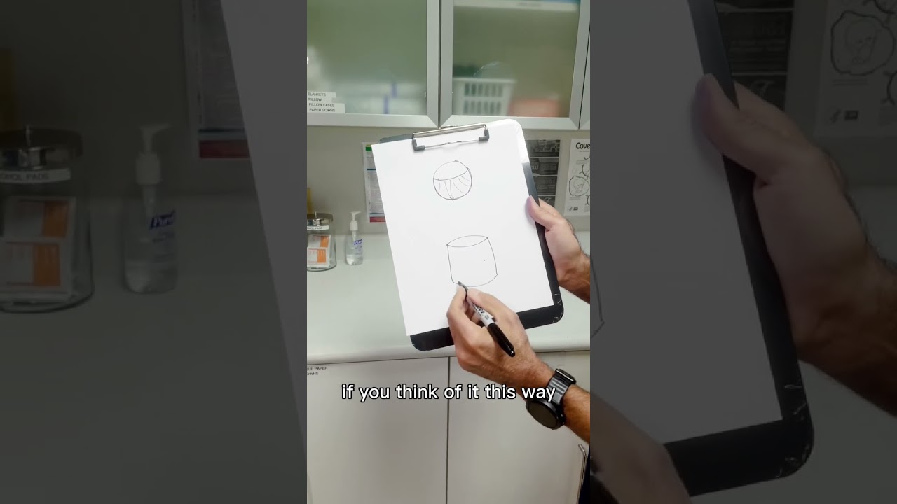 This is how I do a nipple reduction #revisionsurgery #nipplereduction
