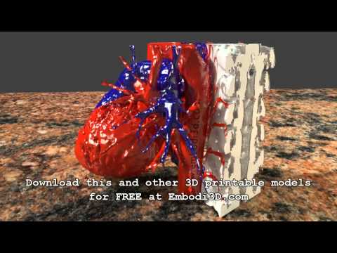 3D Printable Human Heart
