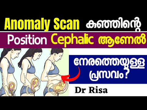 Anomaly Scan Report Malayalam|Cephalic Position|Normal Delivery