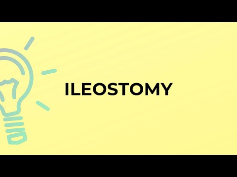 What is the meaning of the word ILEOSTOMY?
