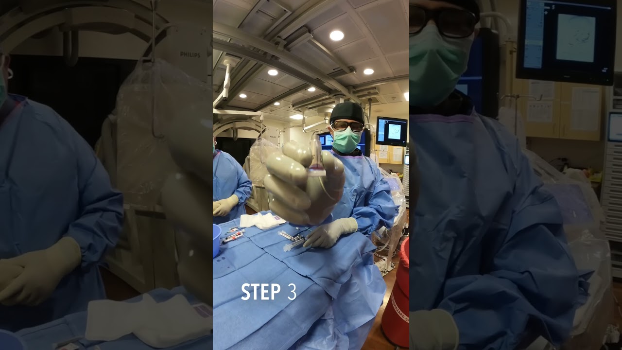 Live Kidney AML Angiomyolipoma Embolization Treatment Doctor