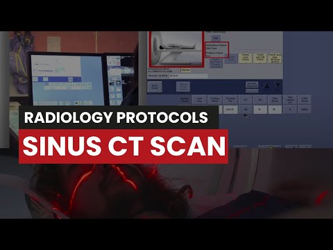 How To Do a CT Scan Of The Sinuses: A Rad Techs Guide