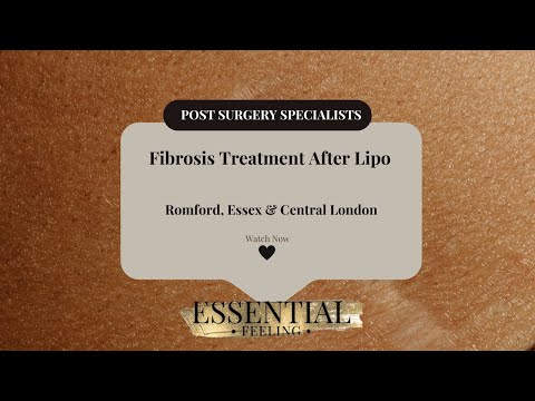 What's the recovery time for lipo 360? Discount at Lipoelastic use 'essentialfeeling' in basket
