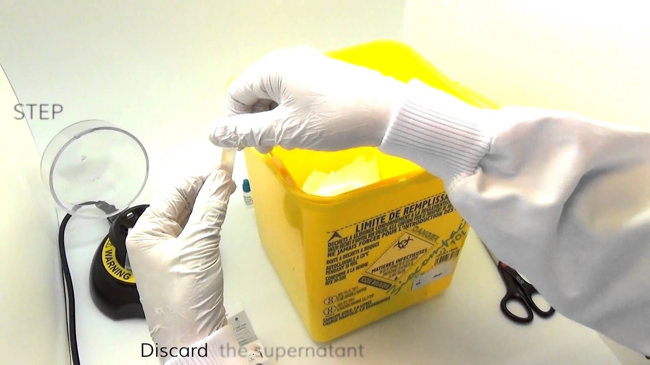 ALVEDIA DAT QUICK TEST PROCEDURE