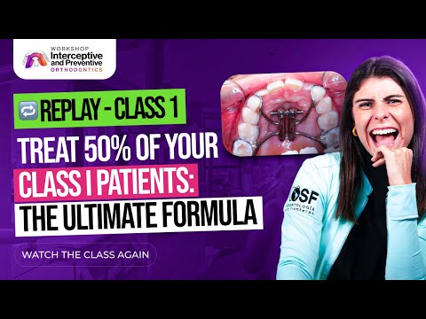 🔴CLASS 1 - Treat 50% of your Class I patients: The ultimate formula🔴