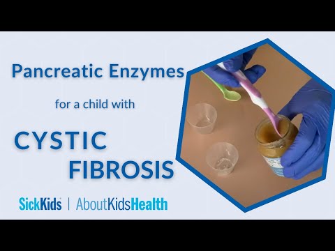 Pancreatic enzymes for infants with cystic fibrosis | AboutKidsHealth at SickKids
