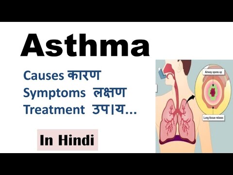 Asthma | Bronchial asthma | Causes, Symptoms, Diagnosis, Treatment, Prevention | Asthma in Hindi