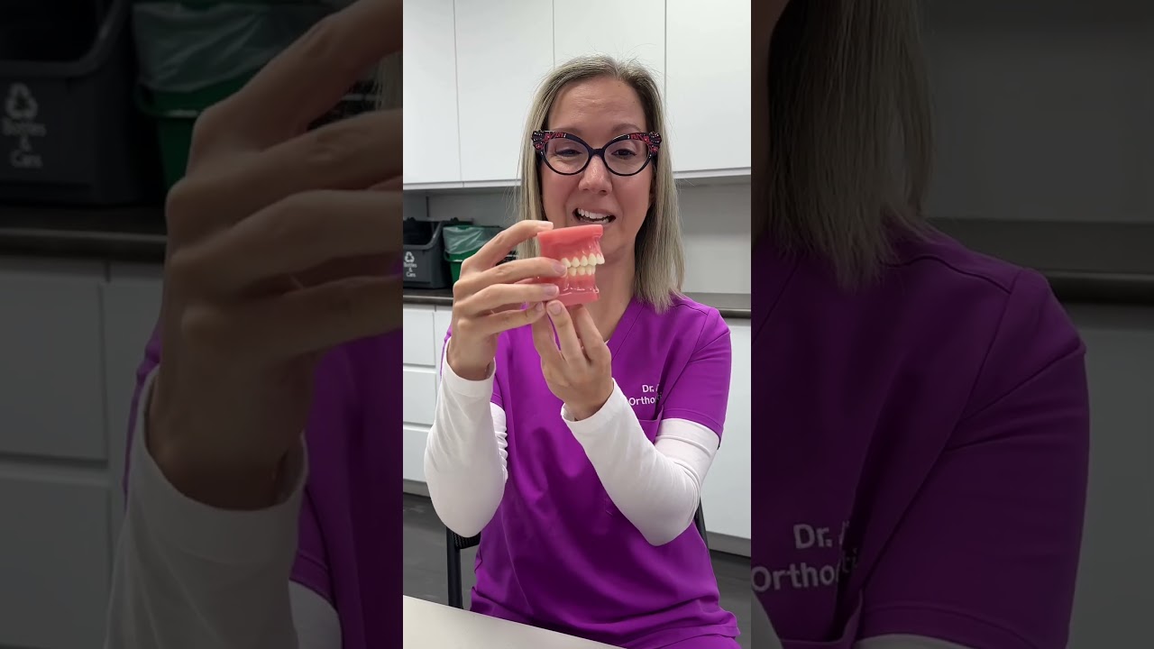 ### Unlock Your Best Smile: Clear Aligners or Braces—Which Will You Choose to Fix Your Overbite? 🌟✨