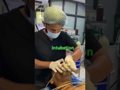 endotracheal intubation