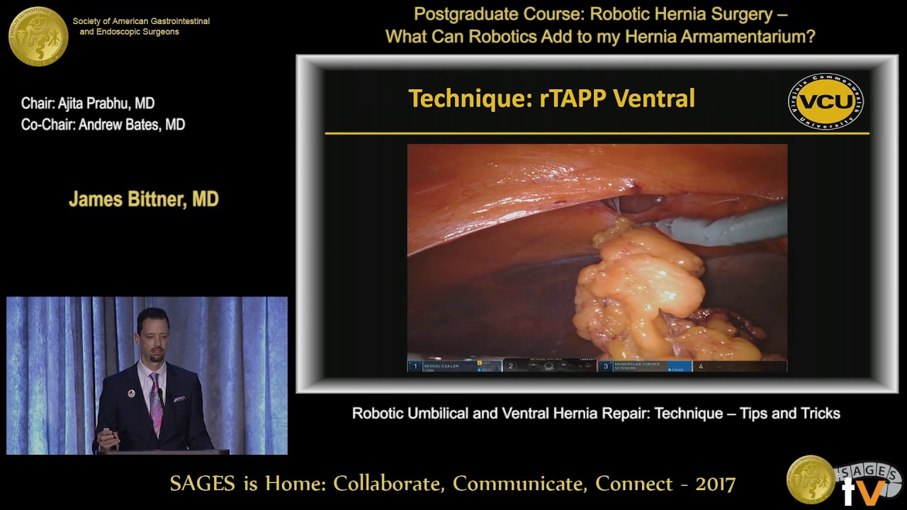 Robotic ventral hernia repair: Tips & tricks
