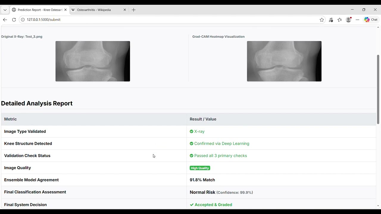 A Novel Method to Predict Knee Osteoarthritis  Using Deep Learning