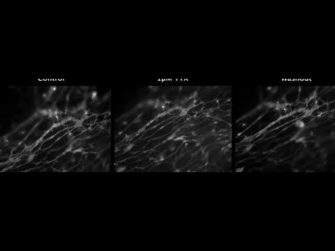 In Vivo Transplantation of Enteric Neural Crest Cells into Mouse Gut; Engraftment, Functional