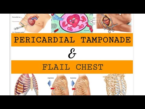 PERICARDIAL TAMPONADE & FLAIL CHEST