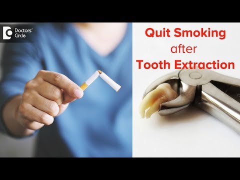 Smoking After Tooth Extraction - How To Discuss