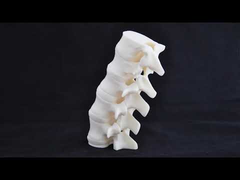 3D printing human spine model – medicine innovating process
