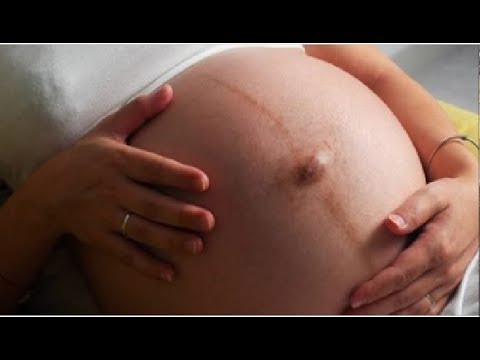 Pregnancy Line Linea Nigra Causes And Tips Learn More