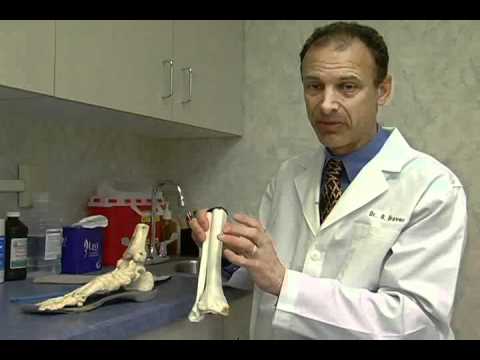 Dr. Richard Braver on Shin Splints: Mybergen.com NJ Health Video | njhealth