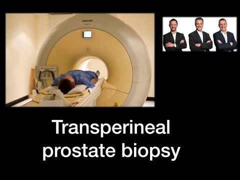 prostate biopsy looking for prostate cancer