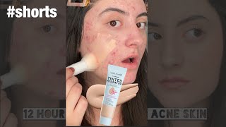 Wet n Wild Tinted Hydrator Skin Tint Application on Acne Skin #shorts