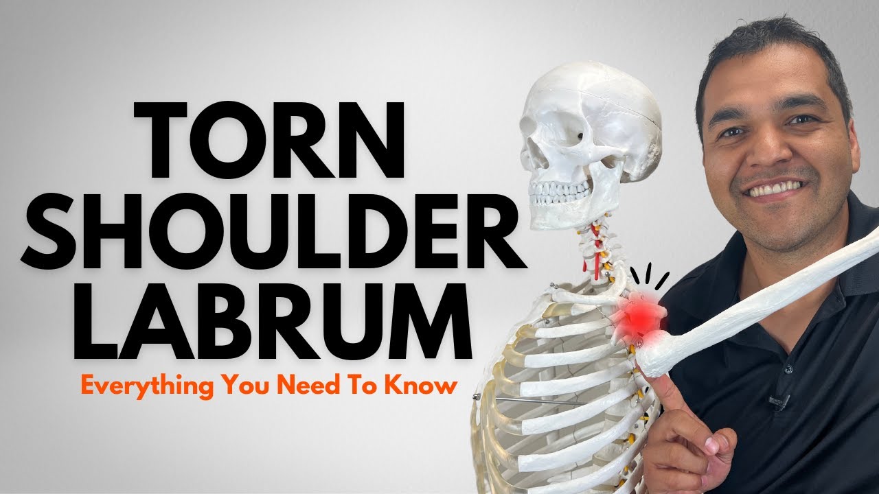 Understanding Torn Shoulder Labrum: Diagnosis, Treatment, and Causes ...