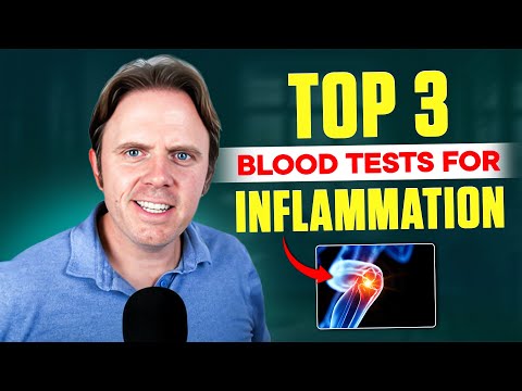Top 3 Lab Tests You Need to Know to Identify Inflammation in Your Body