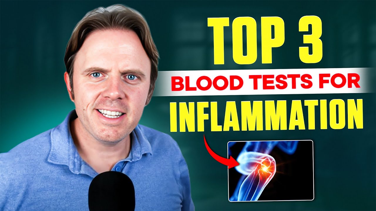 Top 3 Lab Tests You Need to Know to Identify Inflammation in Your Body