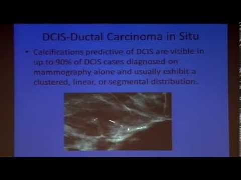 Imaging for Women at High Risk for Breast Cancer