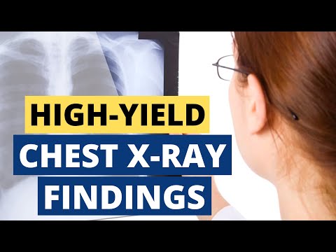 How To Read An X-Ray When Your Attending Asks - Pt 3 (High Yield Findings)