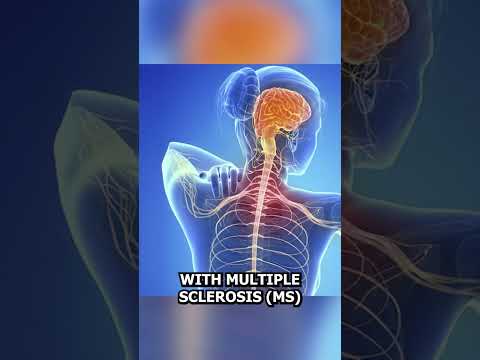 SSDI and Multiple Sclerosis: Navigating the Process