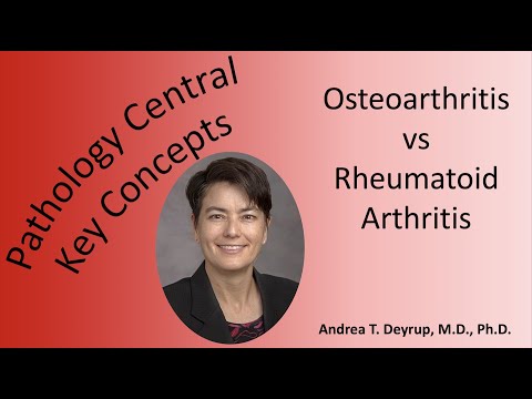 Medical School Pathology: Pathophysiology of Osteoarthritis and Rheumatoid Arthritis