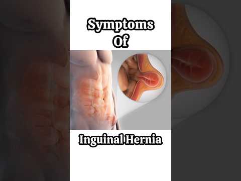 Inguinal hernia symptoms I Hernia treatment in Delhi