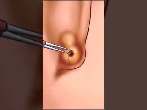 Earring hole clean animation process #asmr
